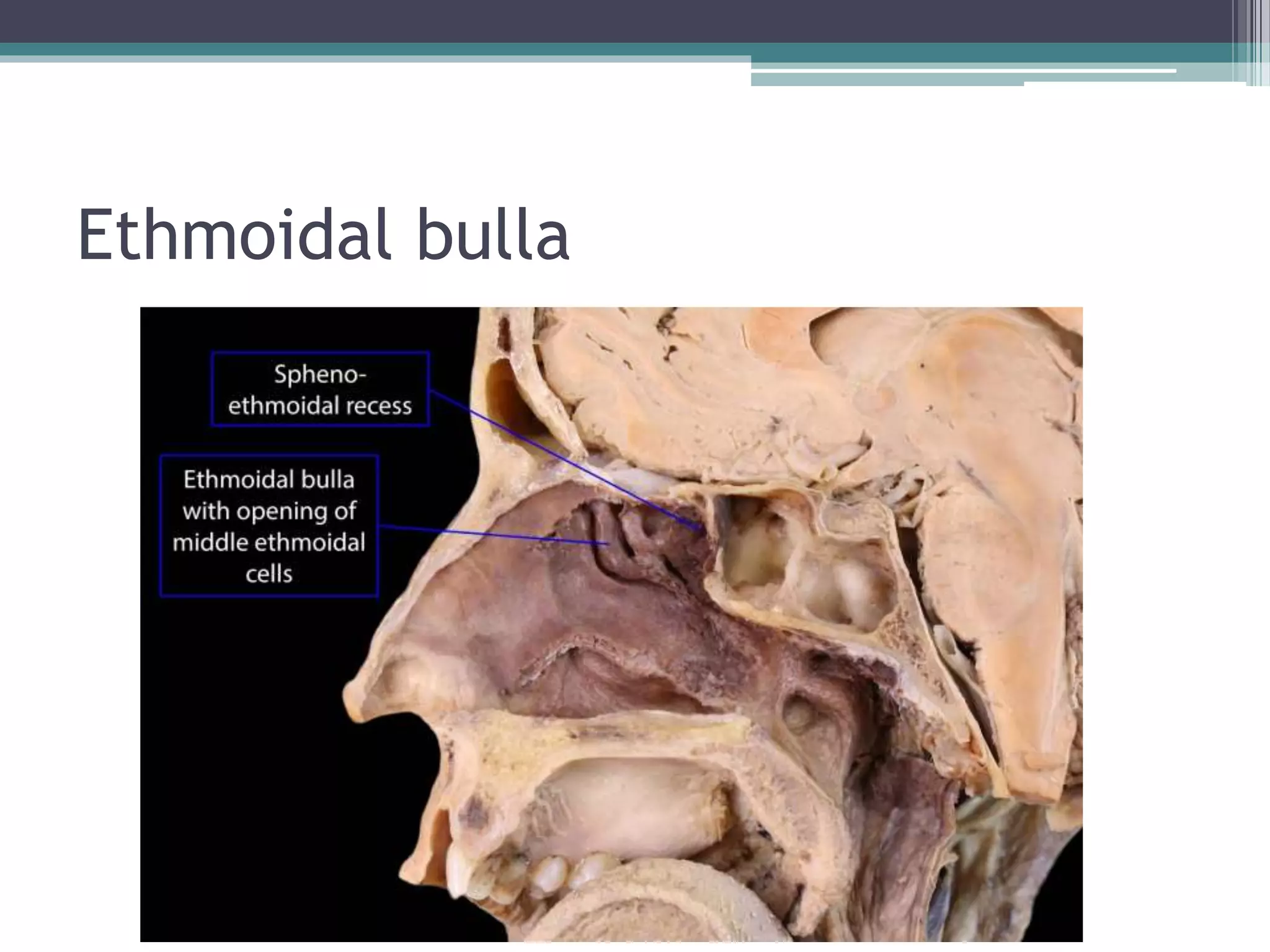 Lateral Wall of Nose | PPTX