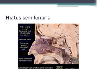 Lateral Wall of Nose | PPTX
