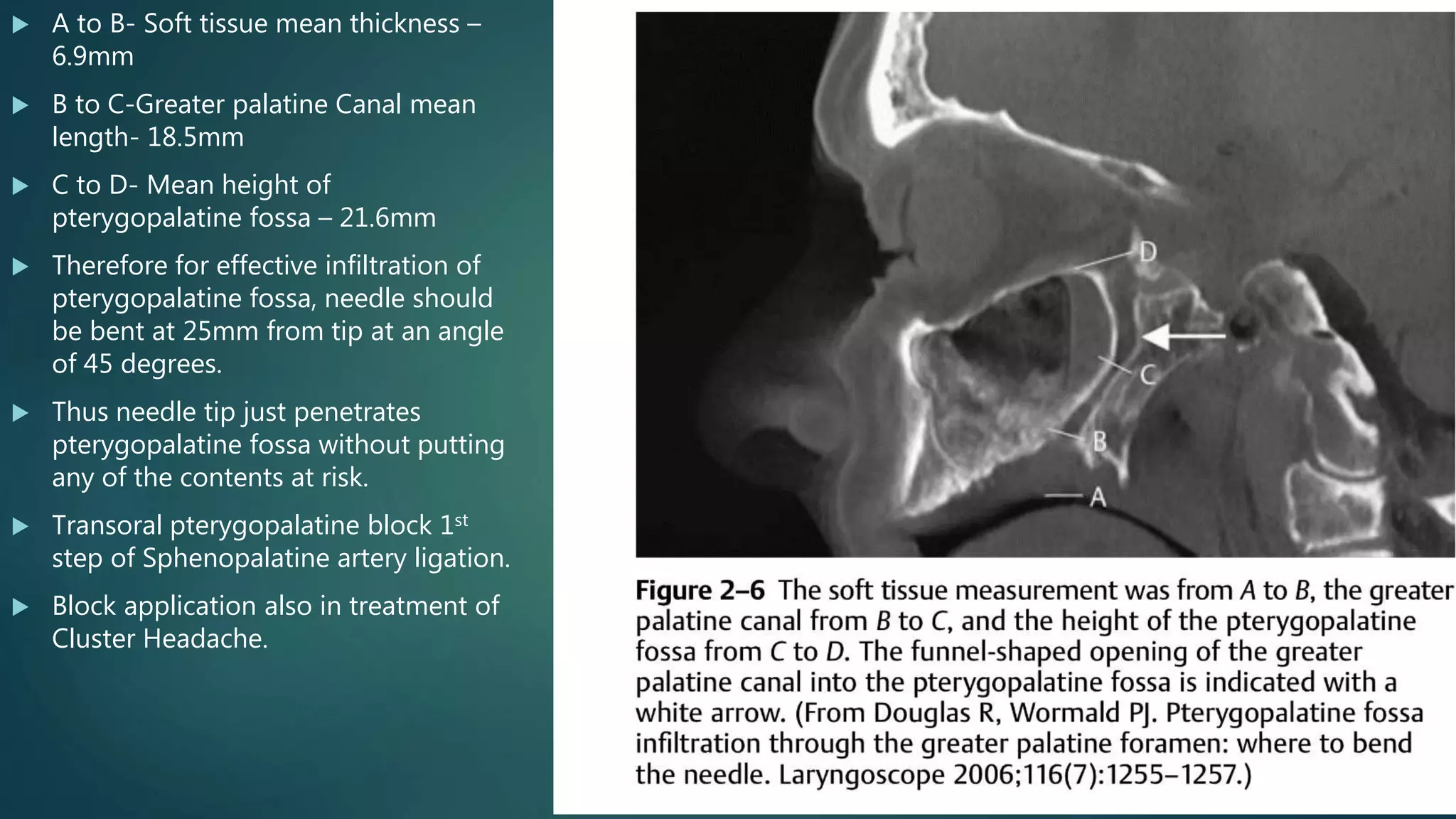 Anatomy of Internal Nose | PPTX