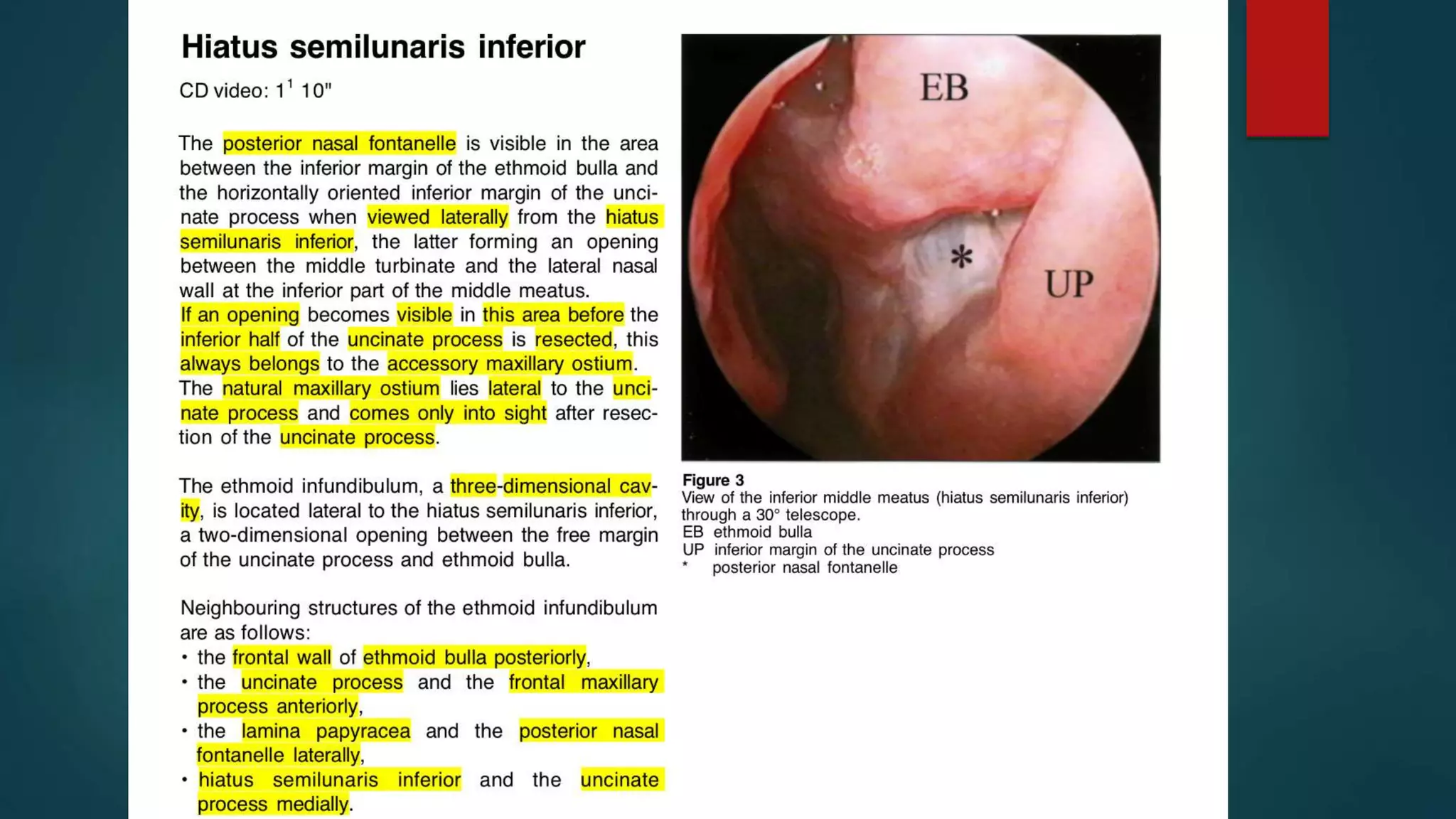 Anatomy of Internal Nose | PPTX