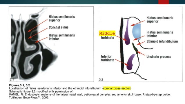 Anatomy of Internal Nose | PPTX | Ear, Nose and Throat Conditions ...