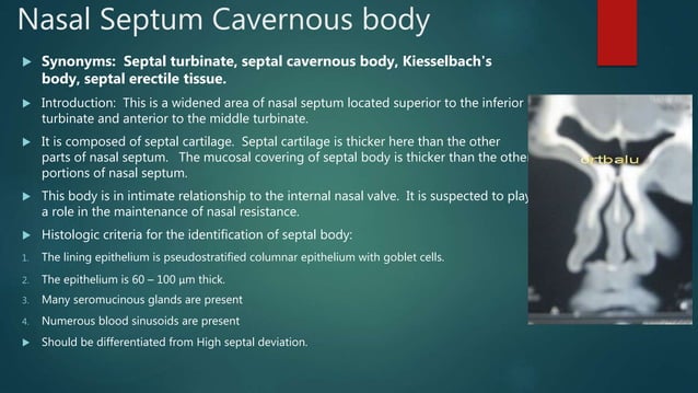 Anatomy of Internal Nose | PPTX | Ear, Nose and Throat Conditions ...