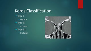 Anatomy of Internal Nose | PPTX | Ear, Nose and Throat Conditions ...