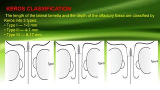 LATERAL WALL OF NOSE.pptx