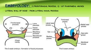 LATERAL WALL OF NOSE.pptx