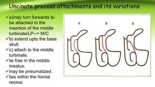 LATERAL WALL OF NOSE.pptx