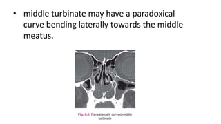 lateral wall of nose.pptx
