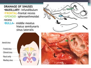 SURGICAL LATERAL WALL OF NOSE (1).ppt