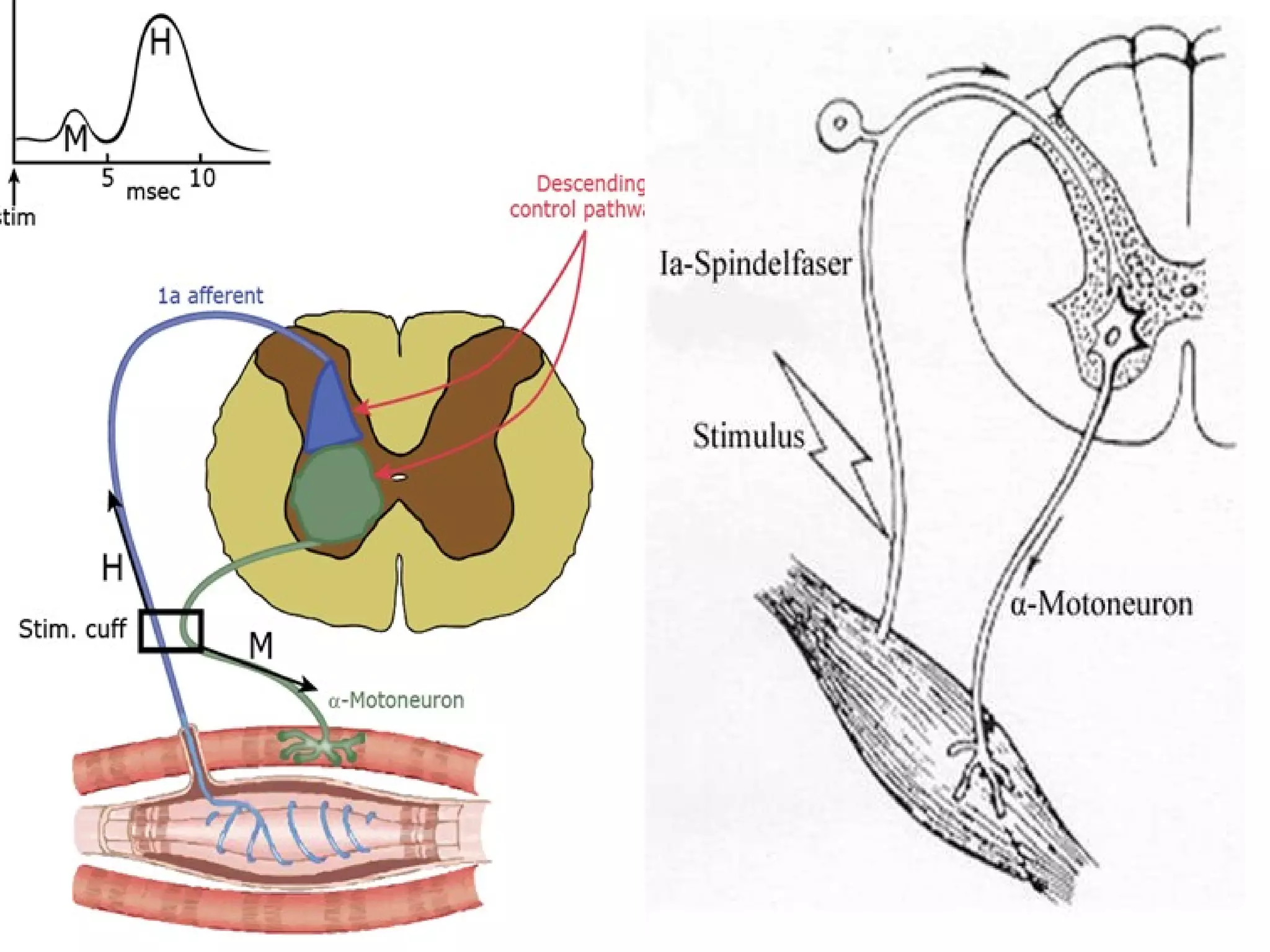Late Responses (F-wave and H.Reflex) | PPT