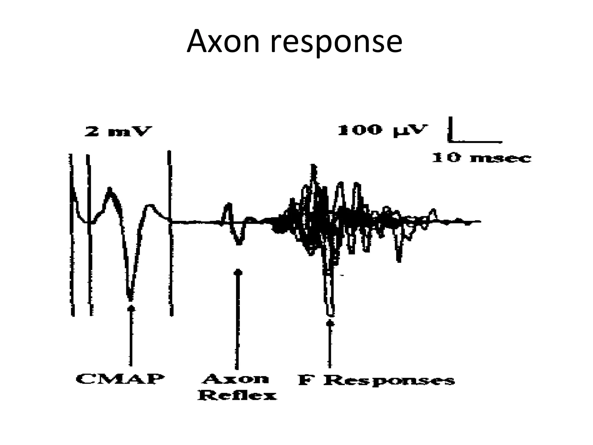Late Responses (F-wave and H.Reflex) | PPT