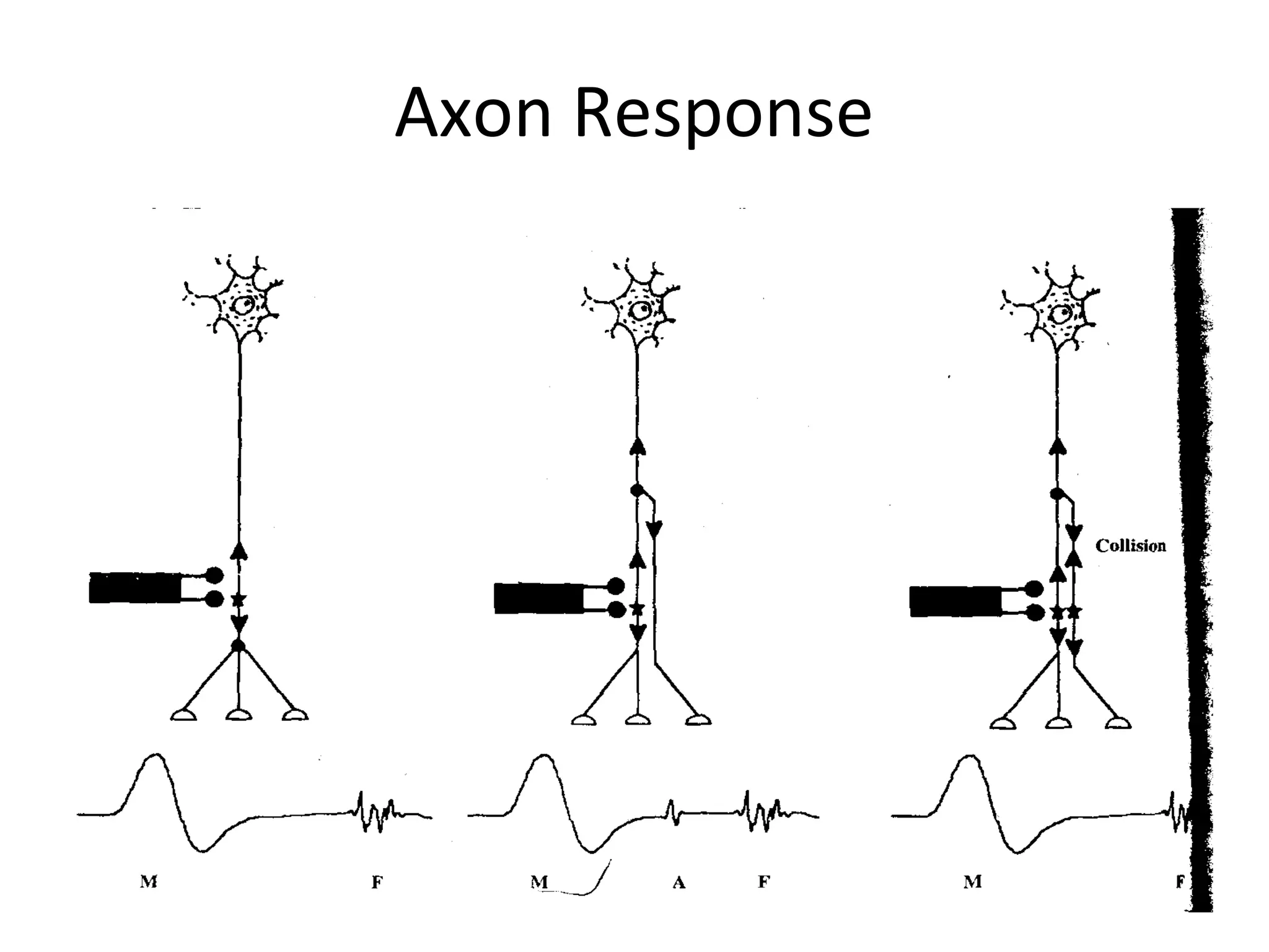 Late Responses (F-wave and H.Reflex) | PPT