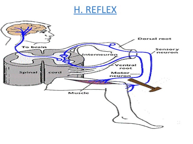Late Responses (F-wave and H.Reflex) | PPT