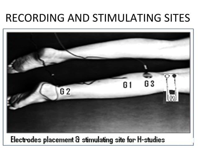 Late Responses (F-wave and H.Reflex) | PPT