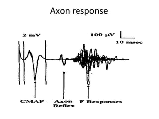 Late Responses (F-wave and H.Reflex) | PPT