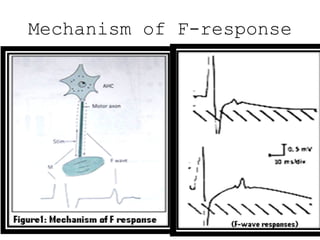 Late Responses (F-wave and H.Reflex) | PPT
