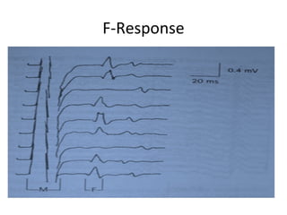 Late Responses (F-wave and H.Reflex) | PPT