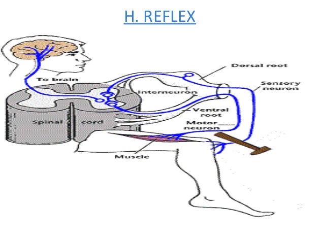 Late Responses (F-wave and H.Reflex)