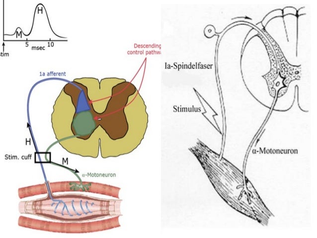 Late Responses (F-wave and H.Reflex)