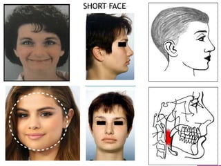 Later stages in development | PPT