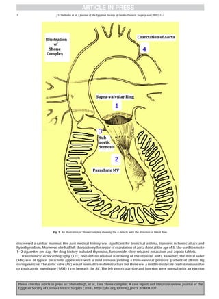 Late shone complex case report and literature review | PDF | Heart and ...