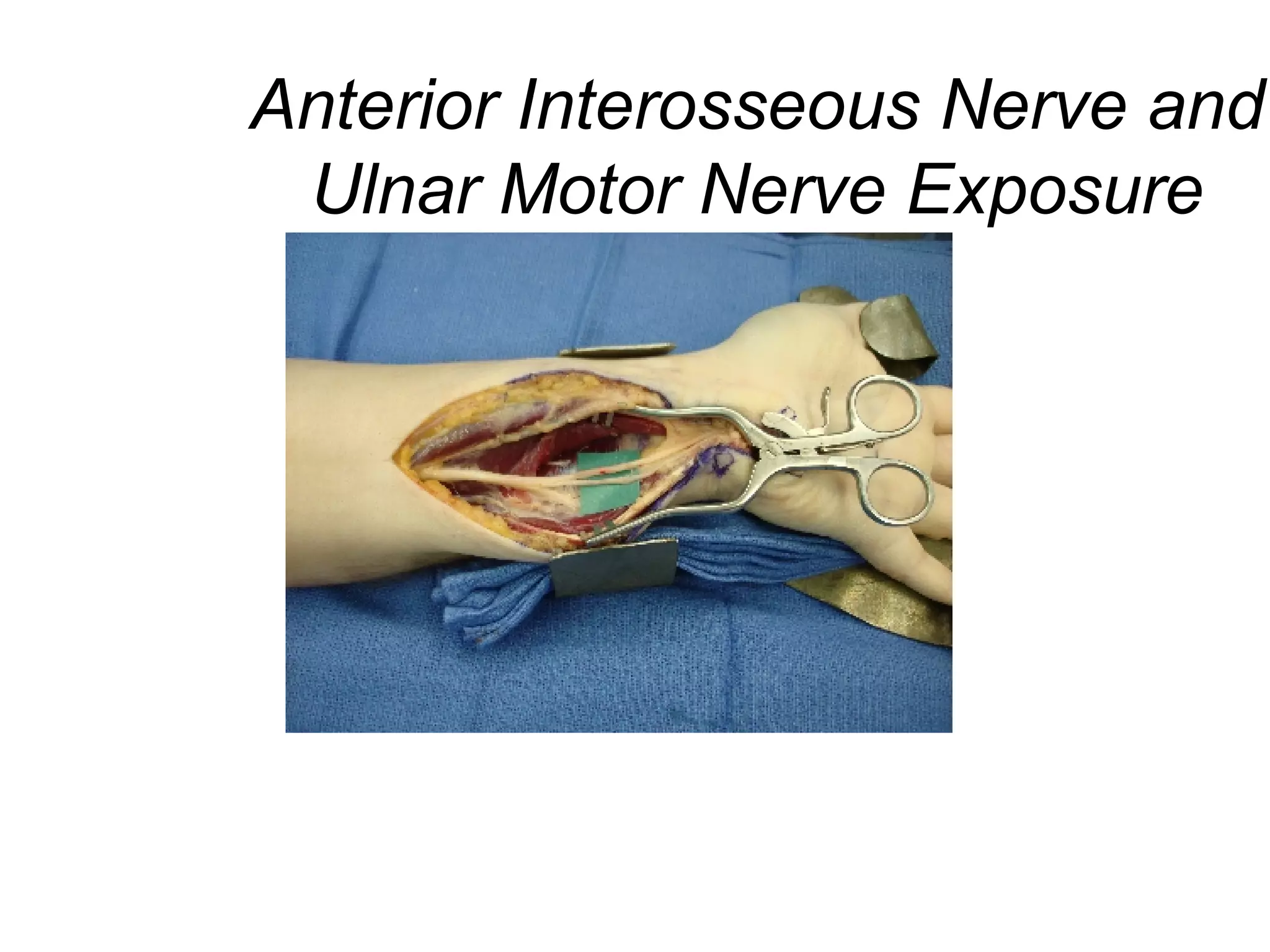Latest In Hand Surgery3 | PPT