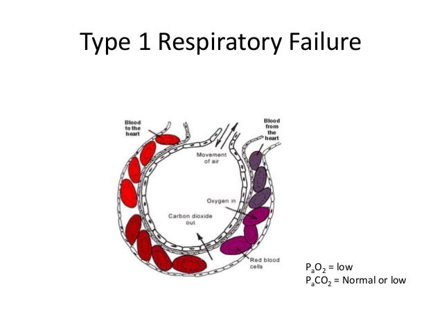 Dyspnoea & Respiratory Failure