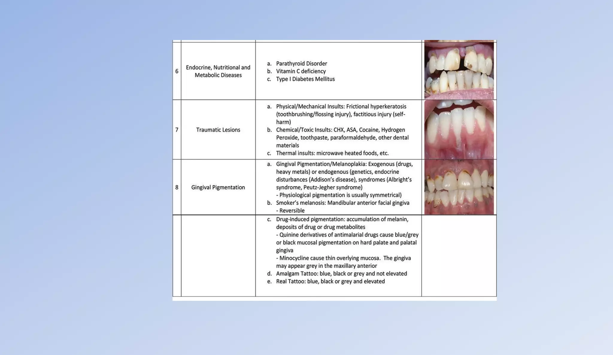 Latest Classification of Periodontal disease..pptx