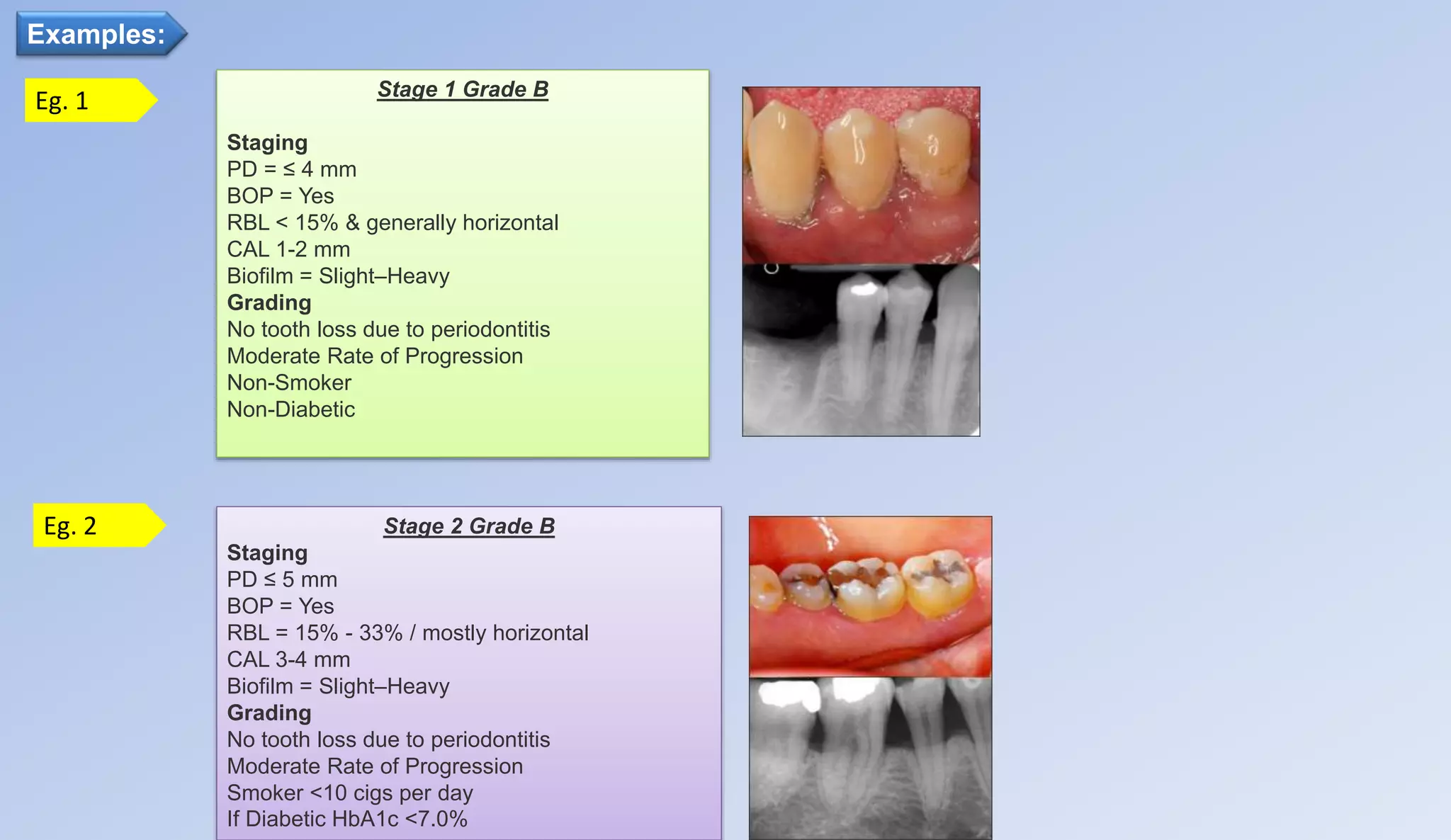 Latest Classification of Periodontal disease..pptx