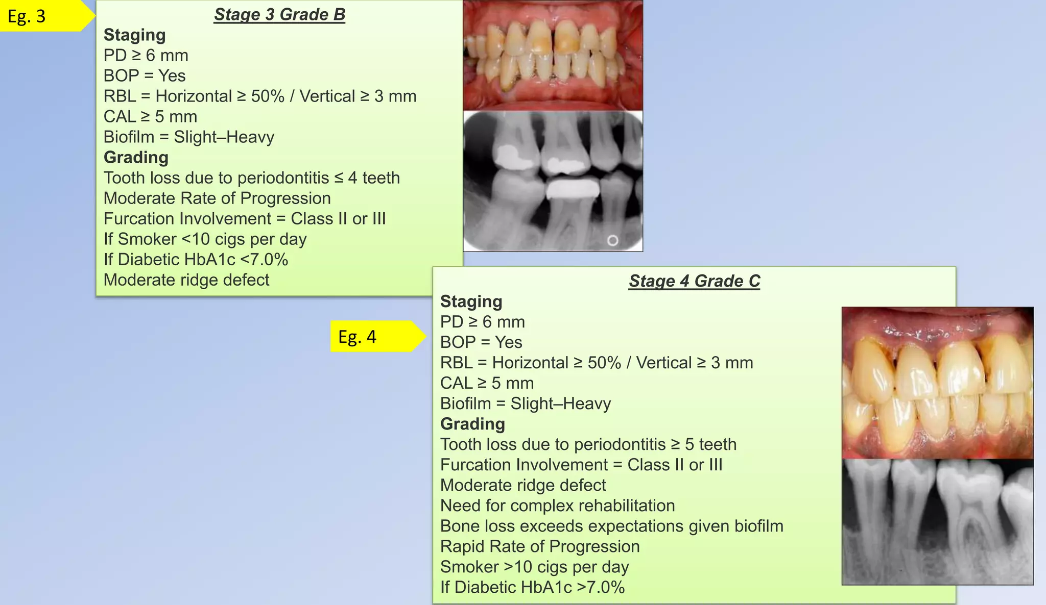 Latest Classification of Periodontal disease..pptx