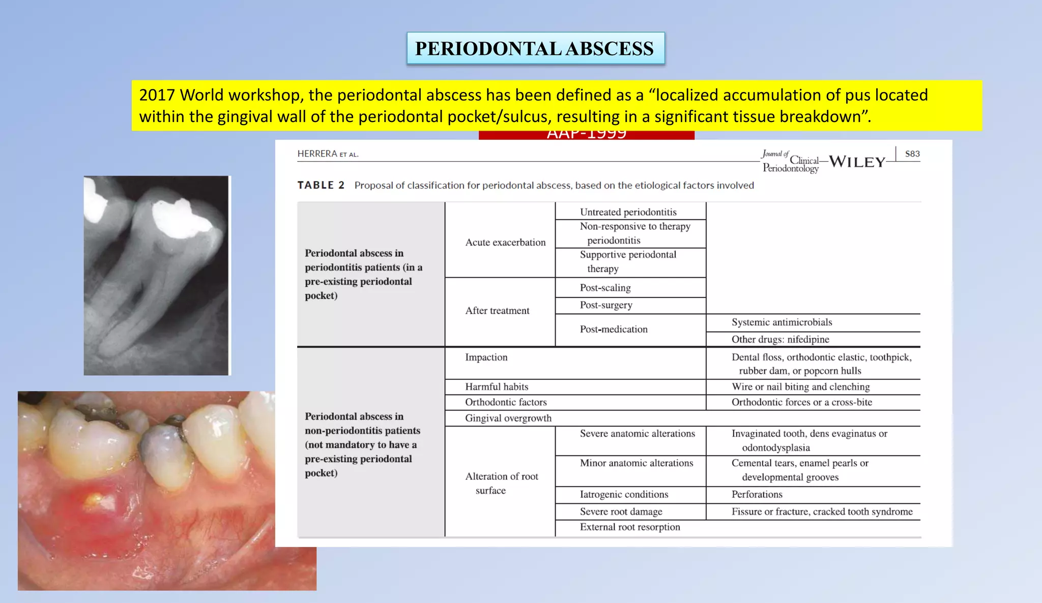 Latest Classification of Periodontal disease..pptx