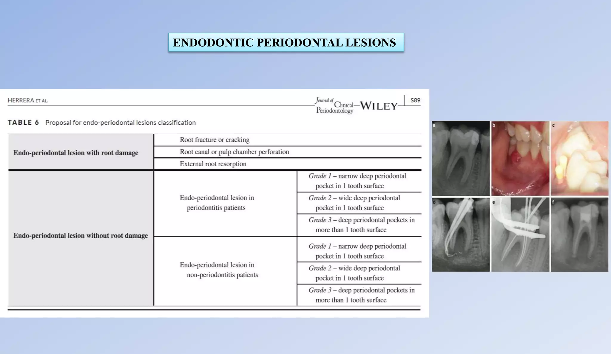 Latest Classification of Periodontal disease..pptx