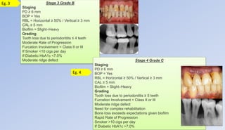Latest Classification of Periodontal disease..pptx