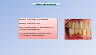 Latest Classification of Periodontal disease..pptx