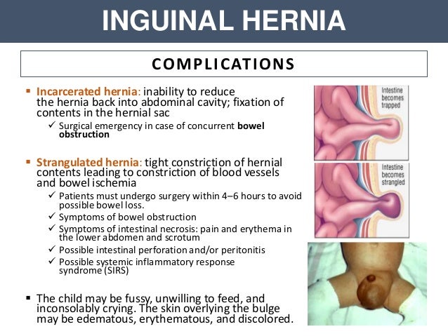 Inguinalscrotal Disease