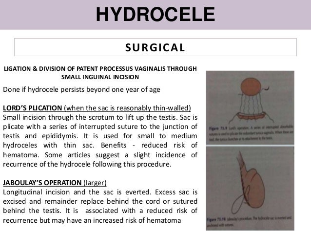 Inguinalscrotal Disease