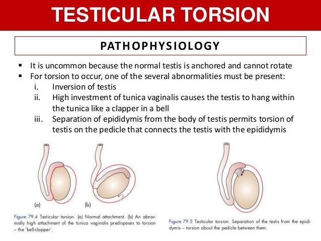 Inguinalscrotal Disease
