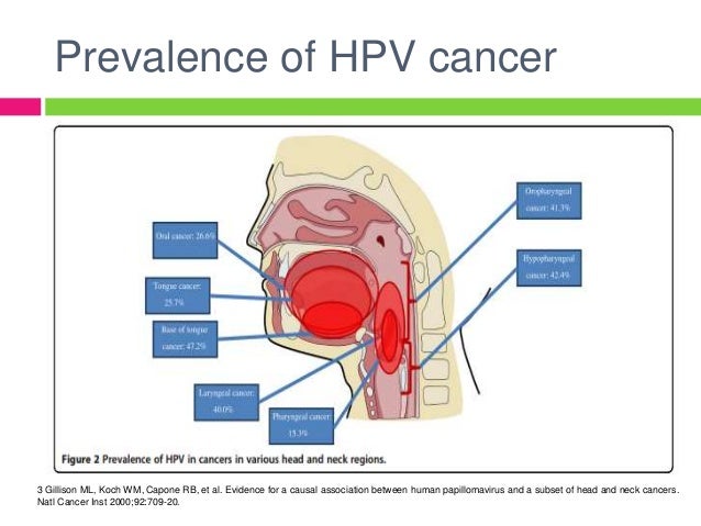 Latest Presentation Of Hpv In Head And Neck
