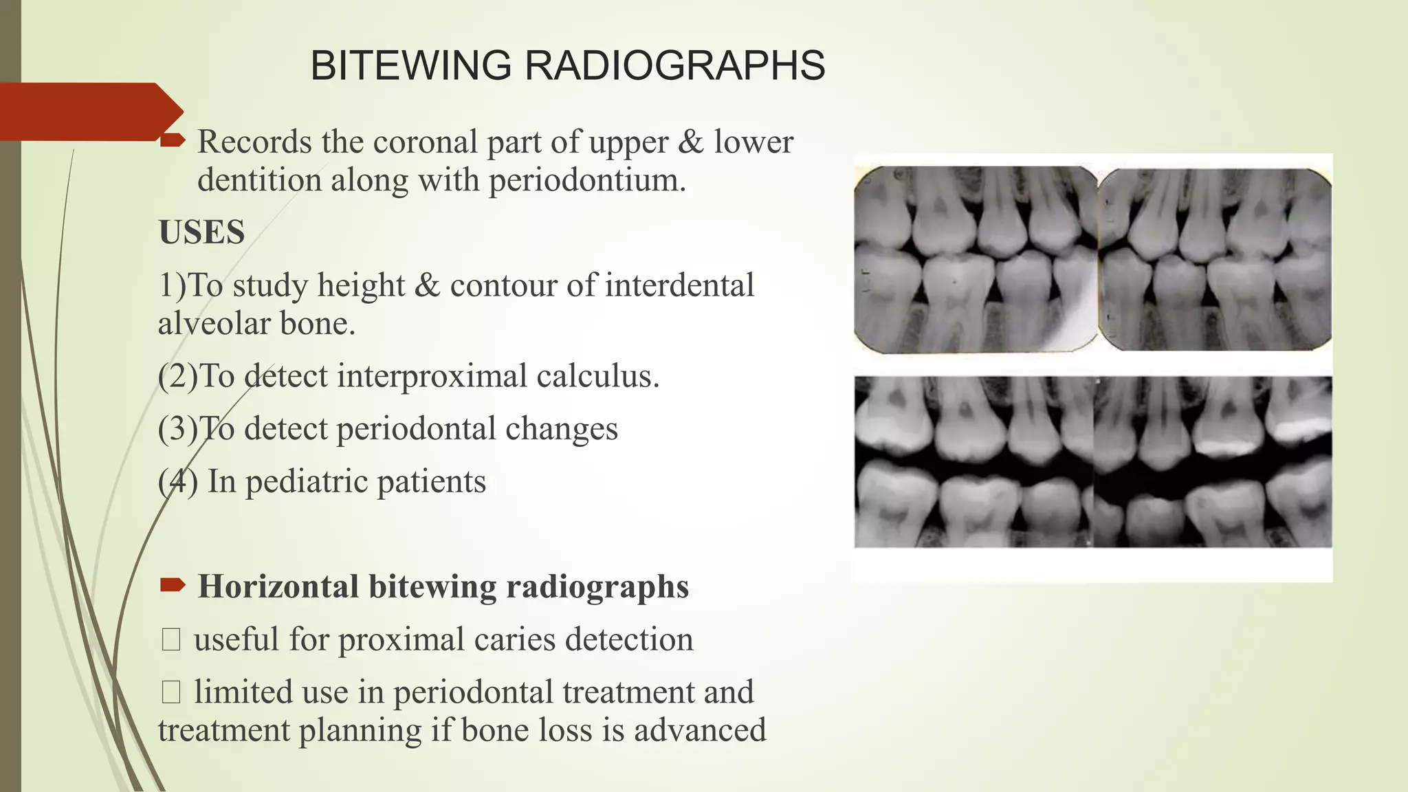 RADIOGRAPHIC AIDS IN THE DIAGNOSIS OF PERIODONTAL DISEASES | PPTX
