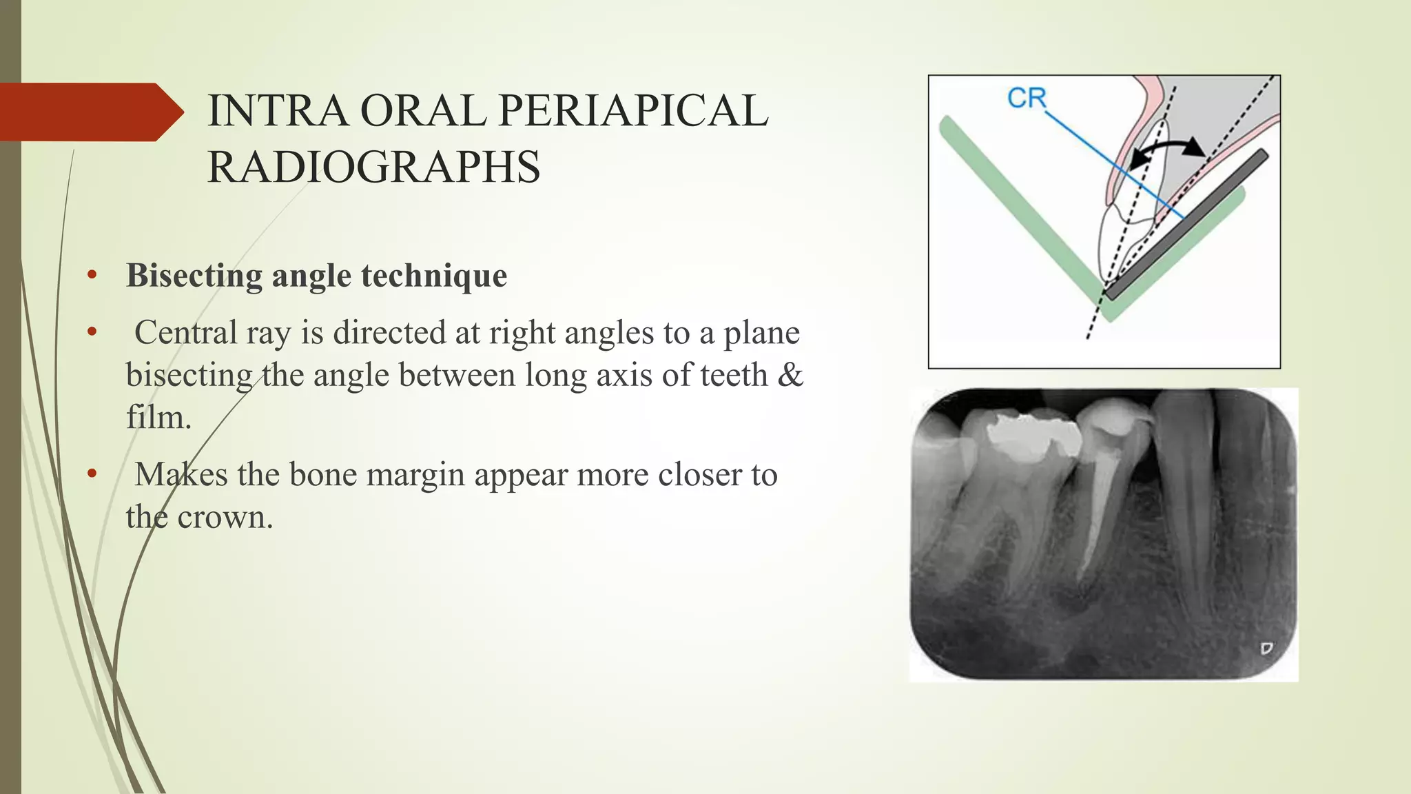 RADIOGRAPHIC AIDS IN THE DIAGNOSIS OF PERIODONTAL DISEASES | PPTX