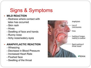 Latex allergy and its management | PPTX