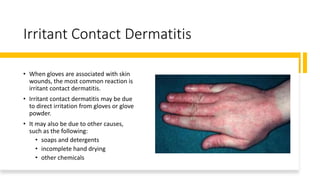 Latex Allergy | PPTX