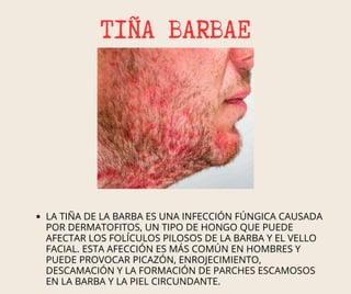 la tiña hongos en el tejido tegumentario | PDF