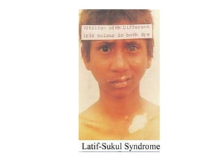 Latif sukul syndrome presentation | PPT