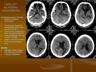 LATIHAN EMERGENCY anjas.ppt