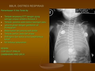 LATIHAN EMERGENCY anjas.ppt