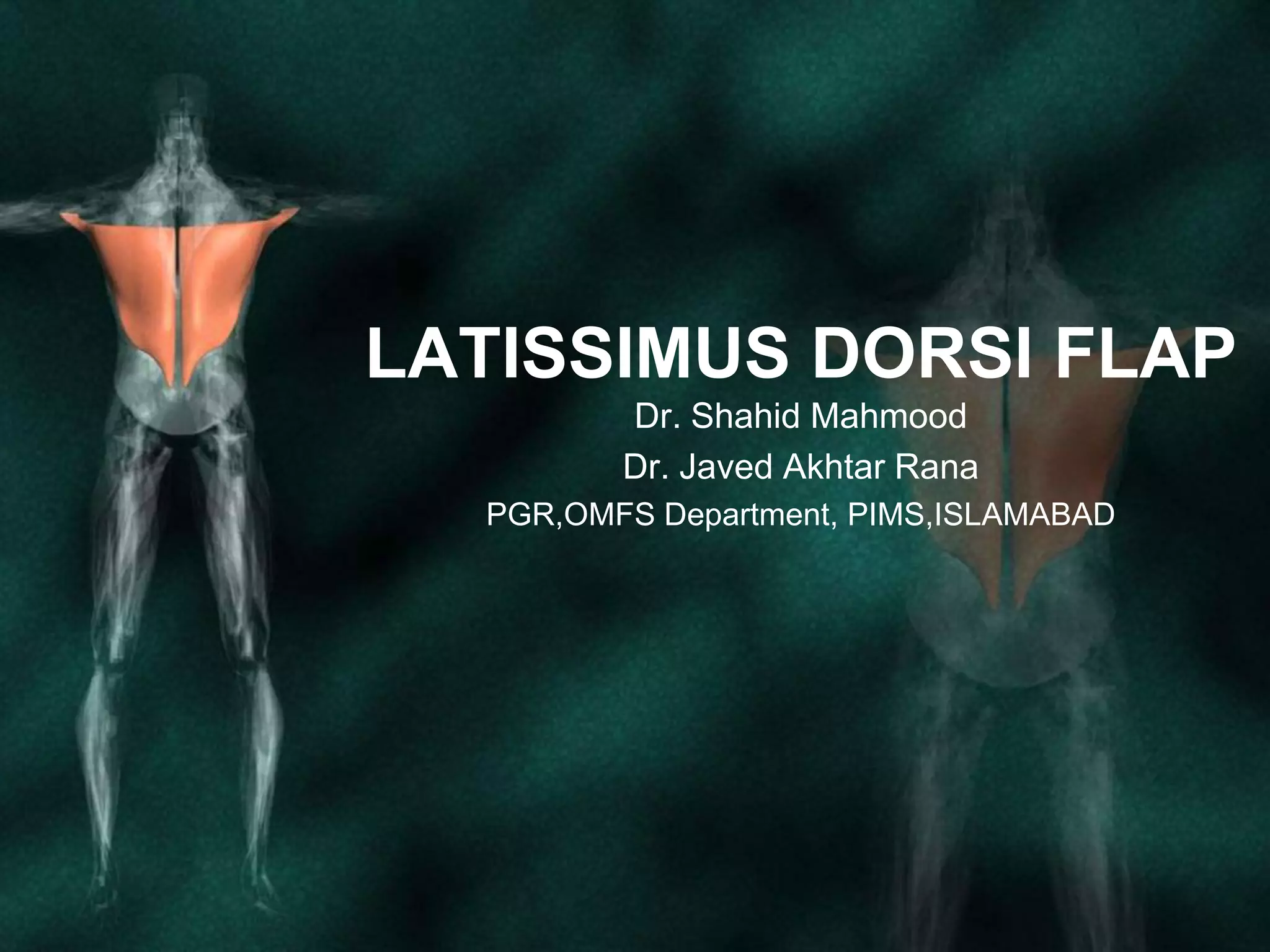 Latissimus dorsi flap for reconstruction in head and neck deffects | PPTX