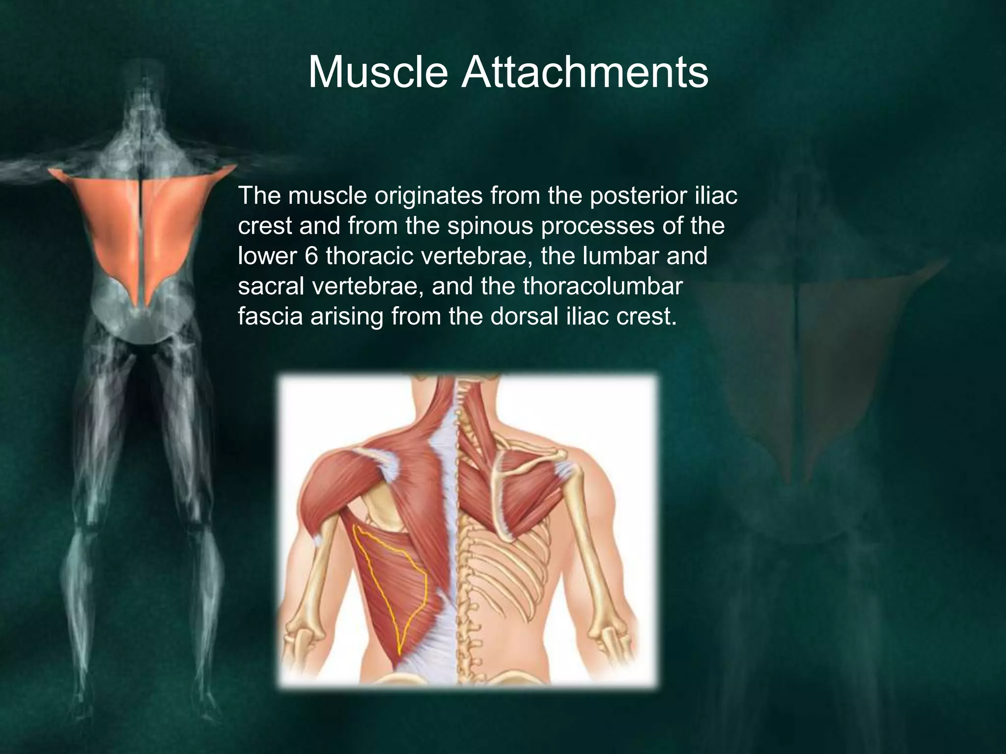 Latissimus dorsi flap for reconstruction in head and neck deffects | PPTX