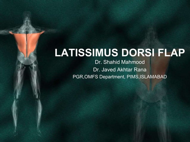 Latissimus dorsi flap for reconstruction in head and neck deffects | PPTX | Death, Injury, or ...