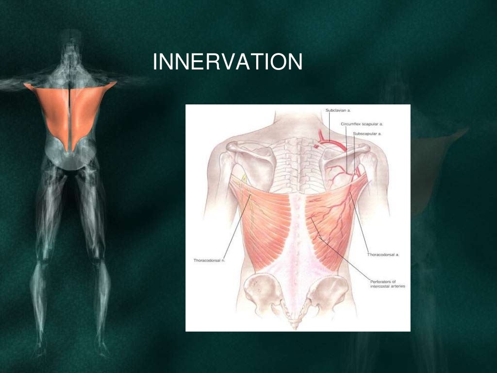Latissimus dorsi flap for reconstruction in head and neck deffects