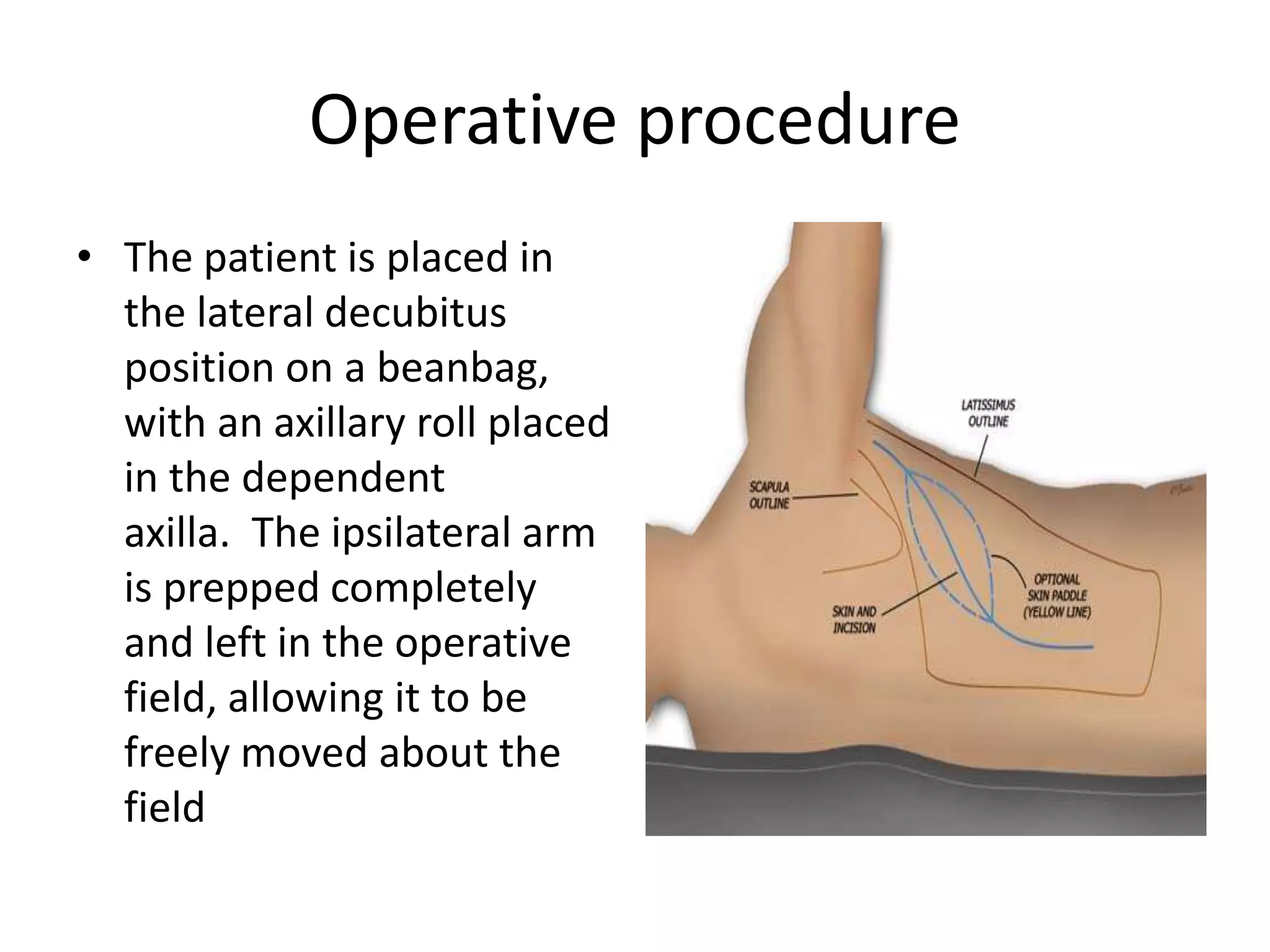 Latissimus dorsi free flap | PPT